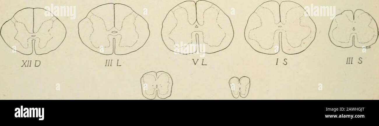 Posterolateral Sulcus