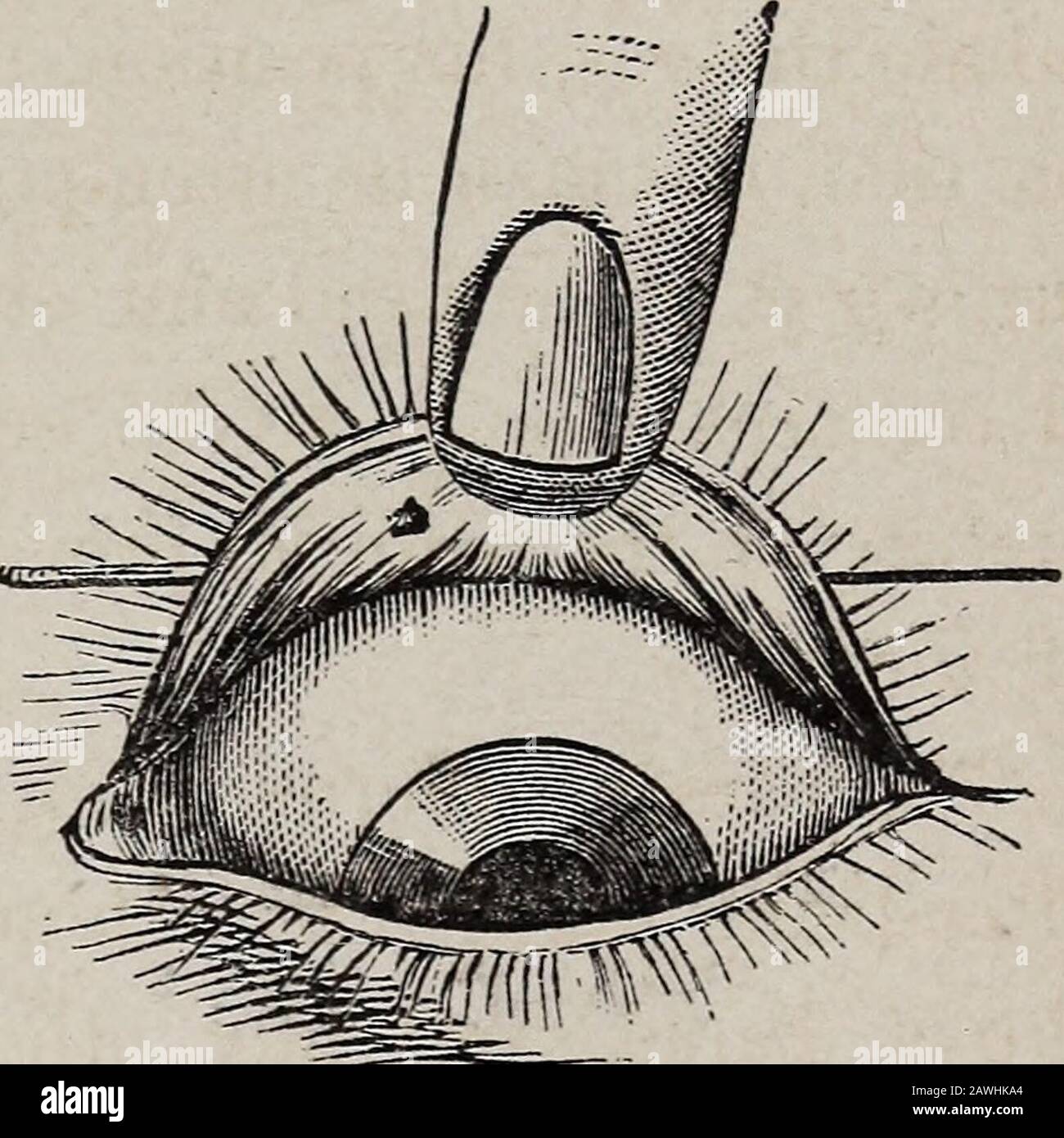 Seen out of corner of eye hi-res stock photography and images - Alamy