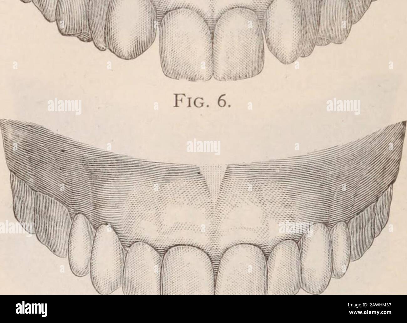 Lowerteeth hi-res stock photography and images - Alamy