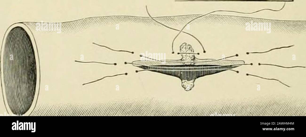 Fig ciiii hi-res stock photography and images - Alamy