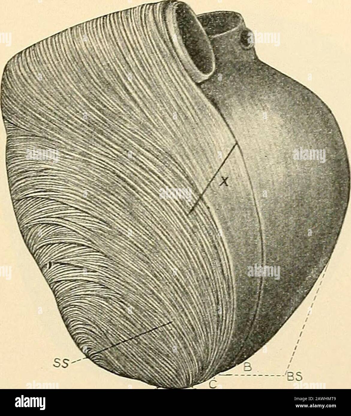 Aorta bulbo hi-res stock photography and images - Alamy