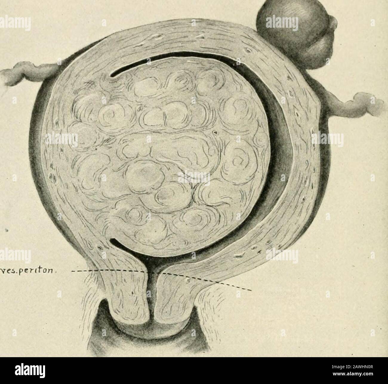 Polypi hi-res stock photography and images - Alamy