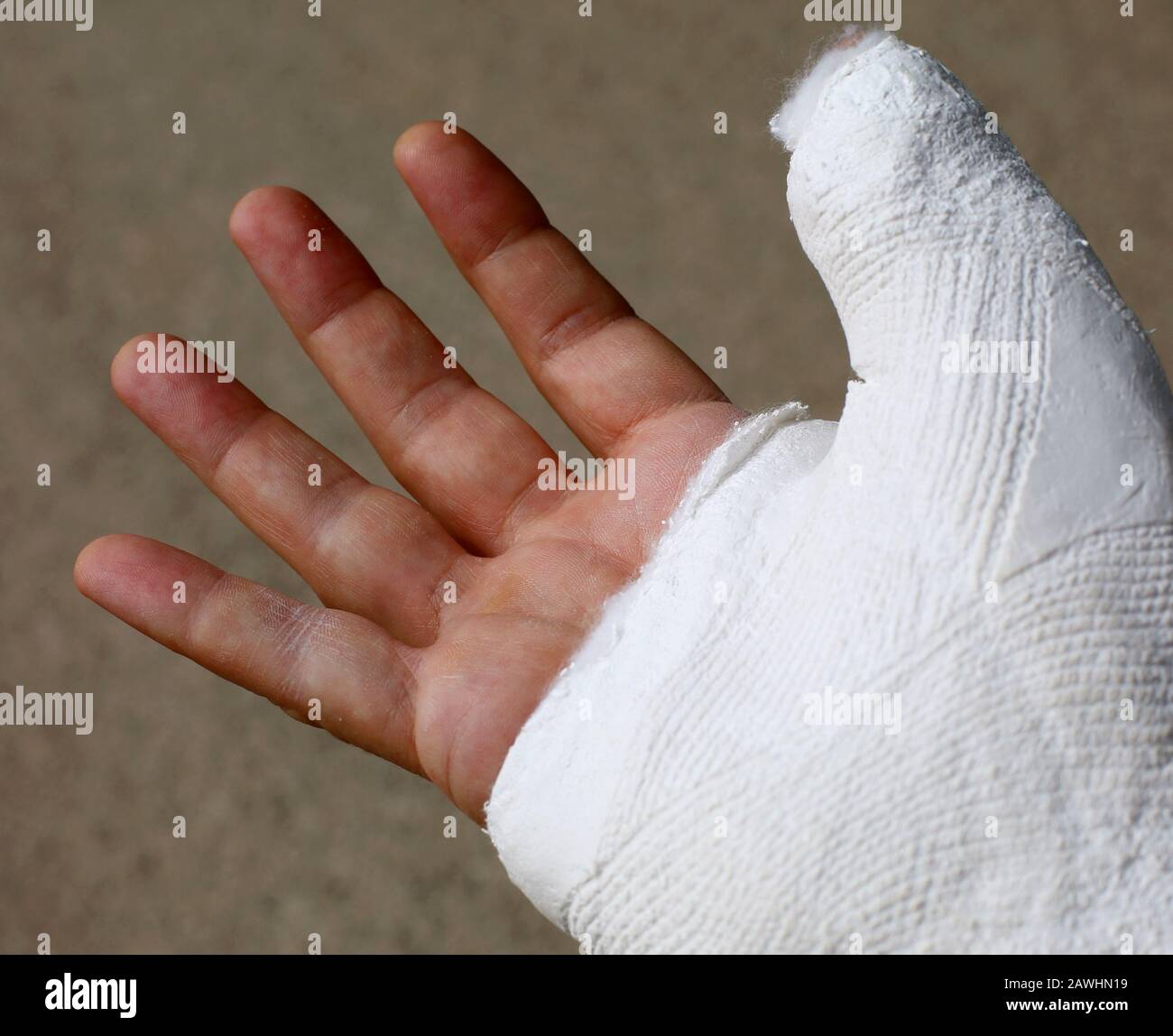 Trauma injured patient bicycle hi-res stock photography and images - Alamy