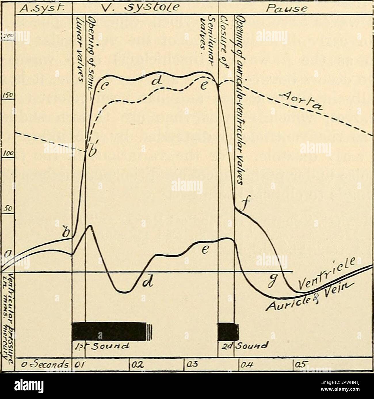 Venous valves hi-res stock photography and images - Alamy