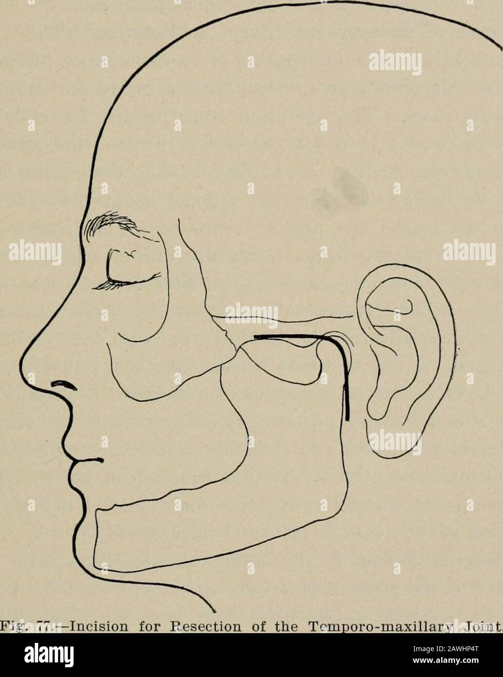 Outer segment membrane hi-res stock photography and images - Alamy