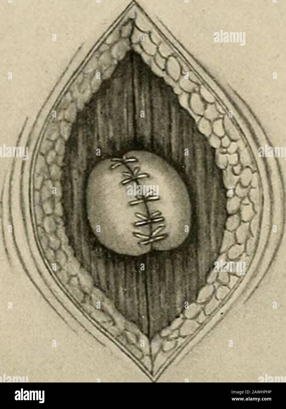 The practice of surgery . terus. If this operation prove unsuccessful ...