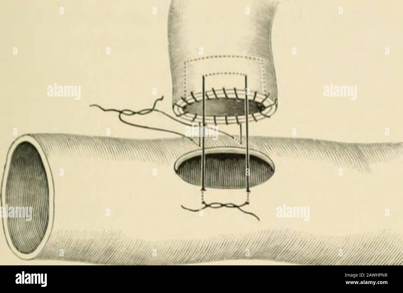 Anatomical junction hi-res stock photography and images - Alamy
