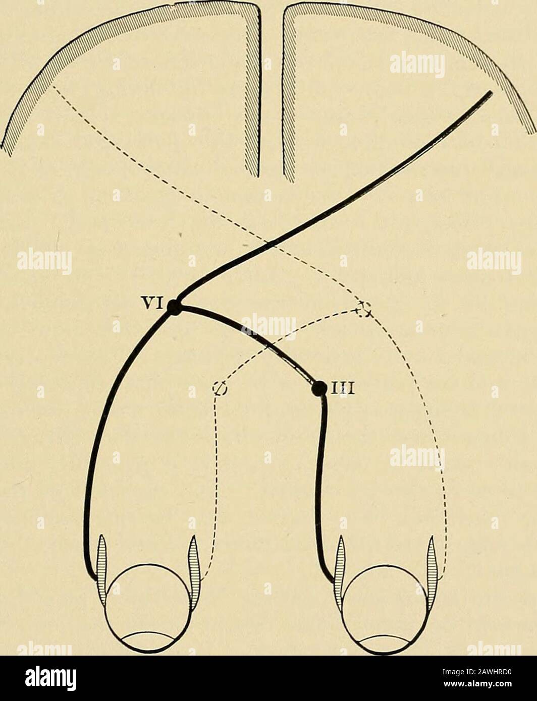 A system of practical medicine . hort duration.The patient may or may ...