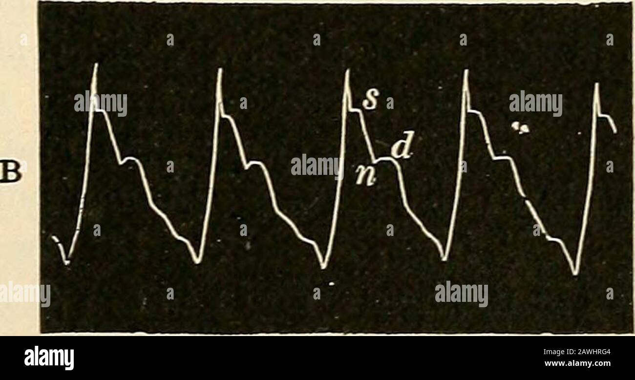 Pulsus celer hi-res stock photography and images - Alamy
