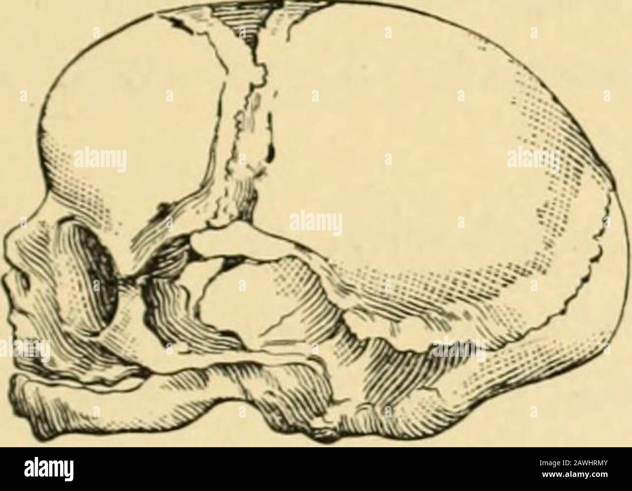 A system of obstetrics . rs at the superior strait in a condition of ...