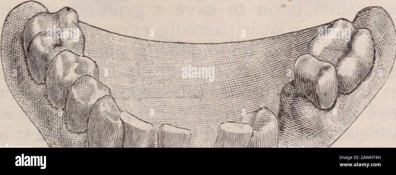 Dental cosmos . superior right second molar and superior right wisdom ...