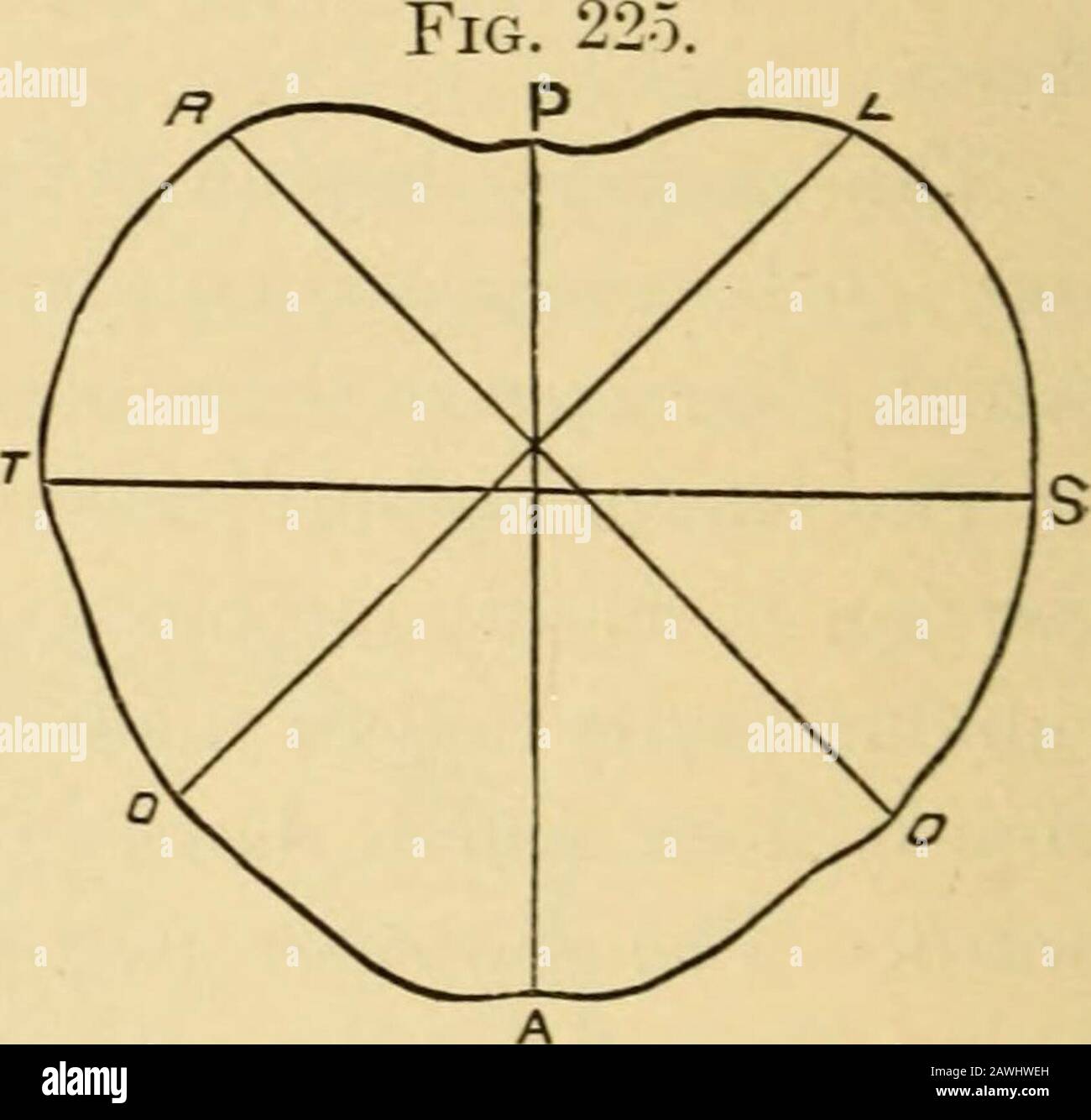 A system of obstetrics . Transverse Section of Pelvis,diameters ...