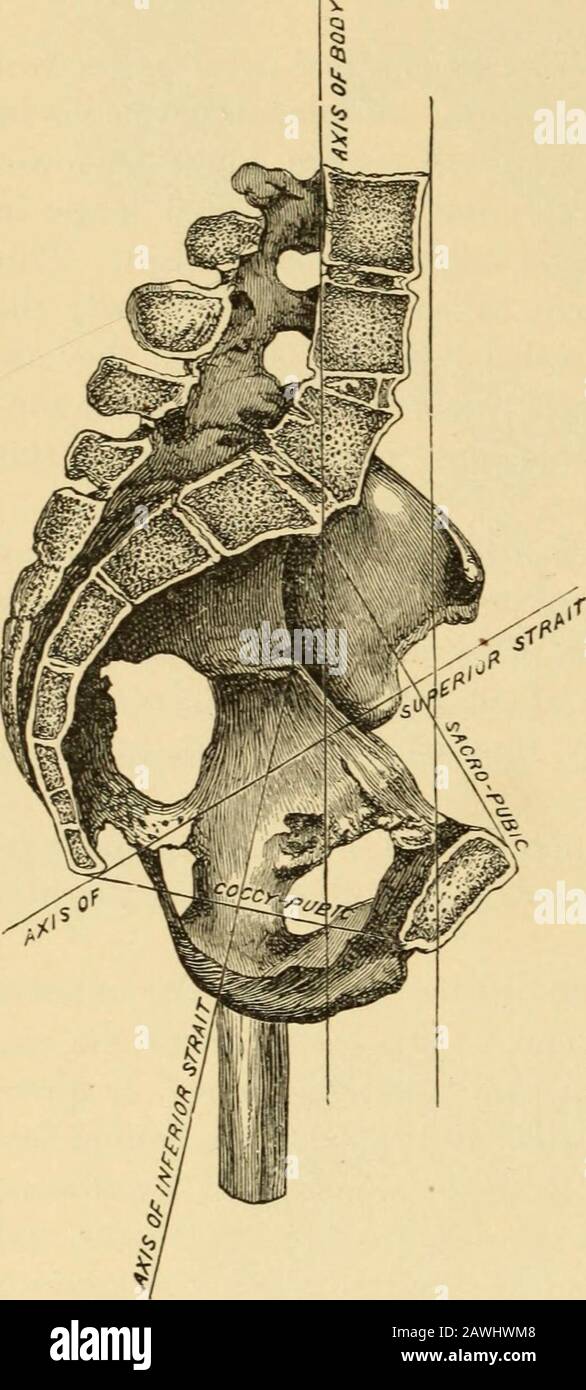Anterior rami hi-res stock photography and images - Alamy