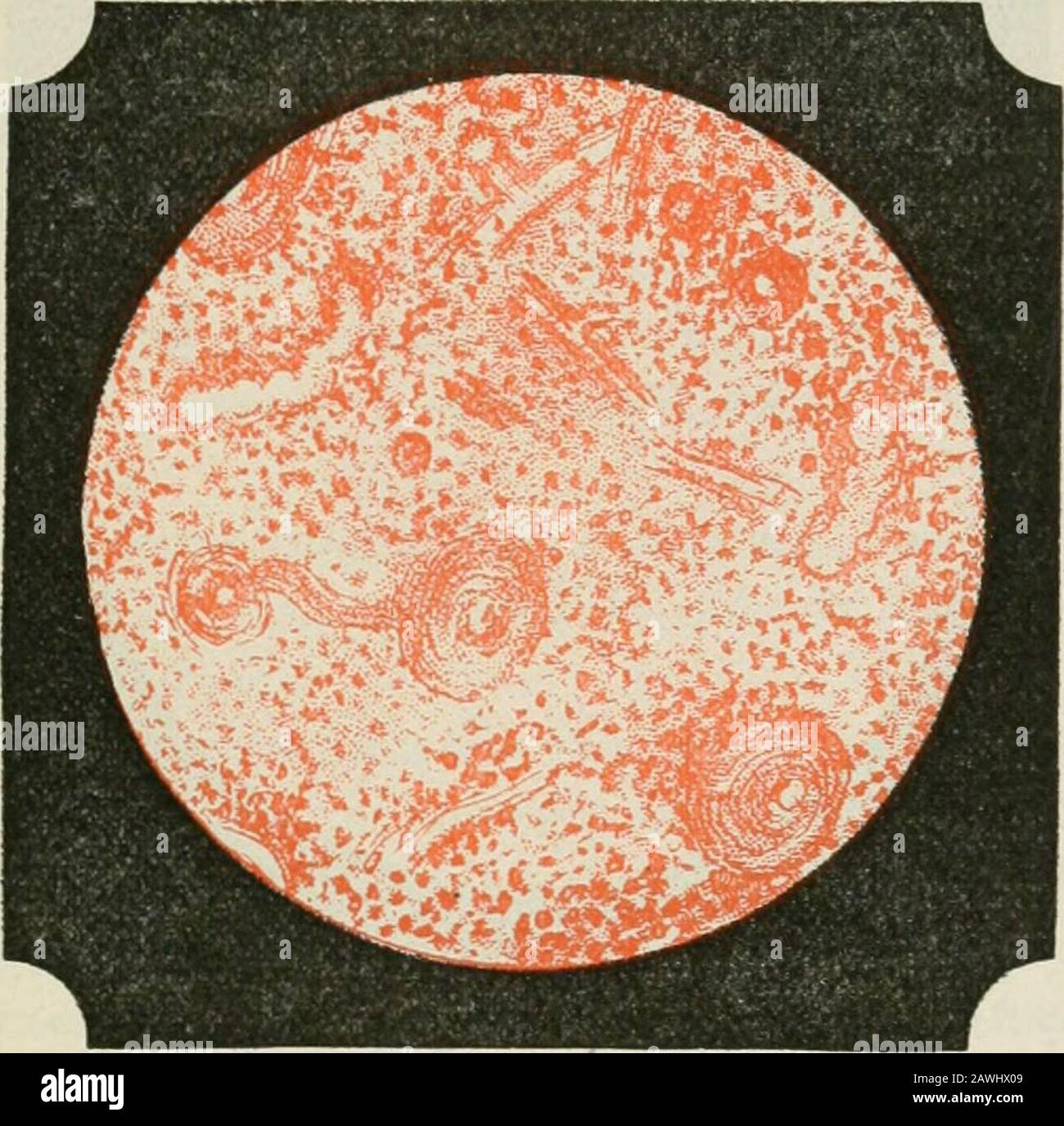 Lectures on nervous diseases from the standpoint of cerebral and spinal ...