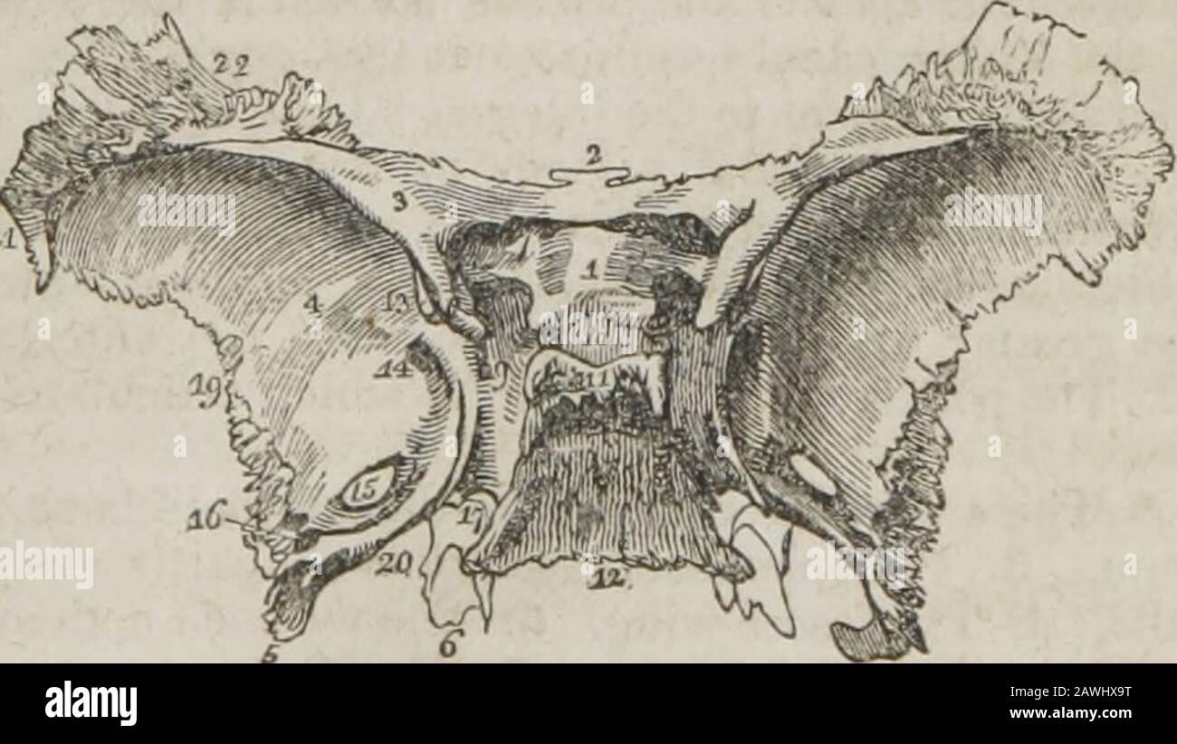 Sella Turcica Of Sphenoid Bone