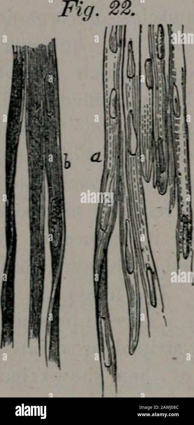 Abdomen inverted hi-res stock photography and images - Alamy