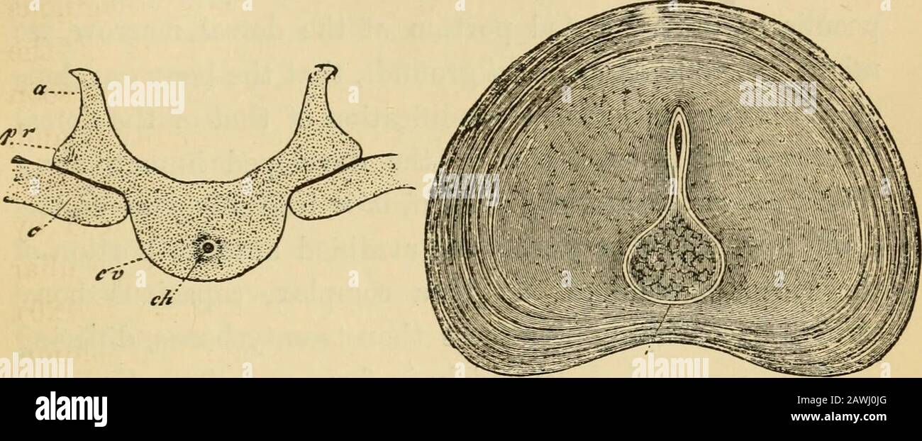 Human Notochord