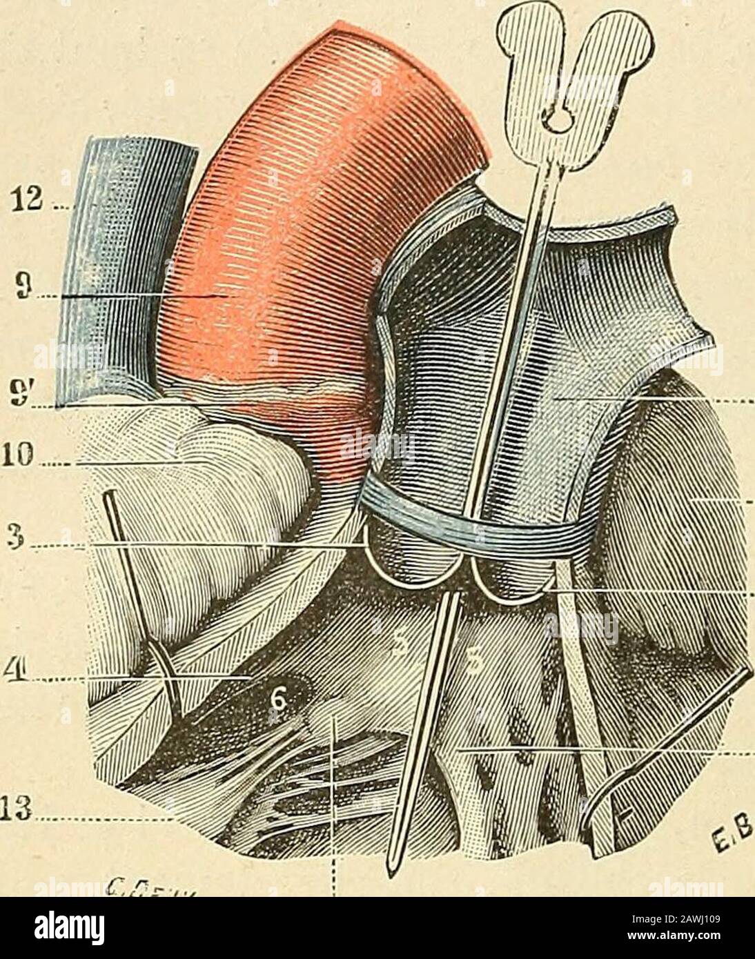 Tronc pulmonaire hi-res stock photography and images - Alamy