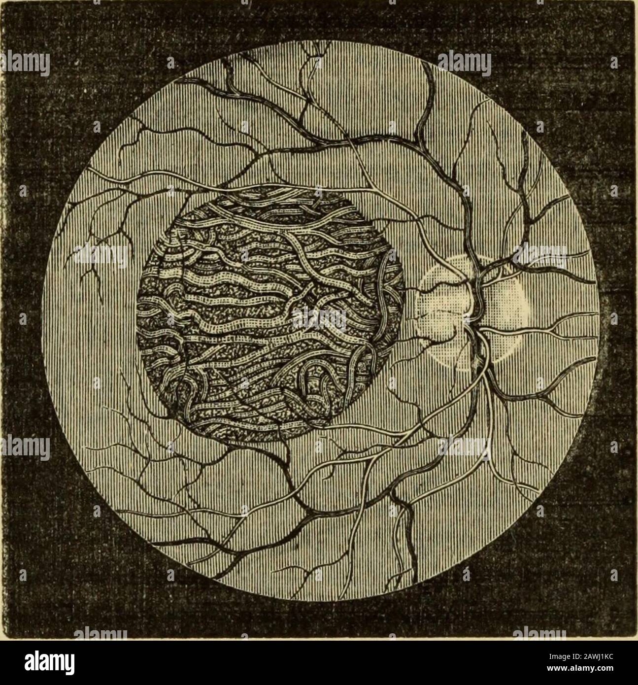 The student's guide to diseases of the eye . me of theseappearances ...