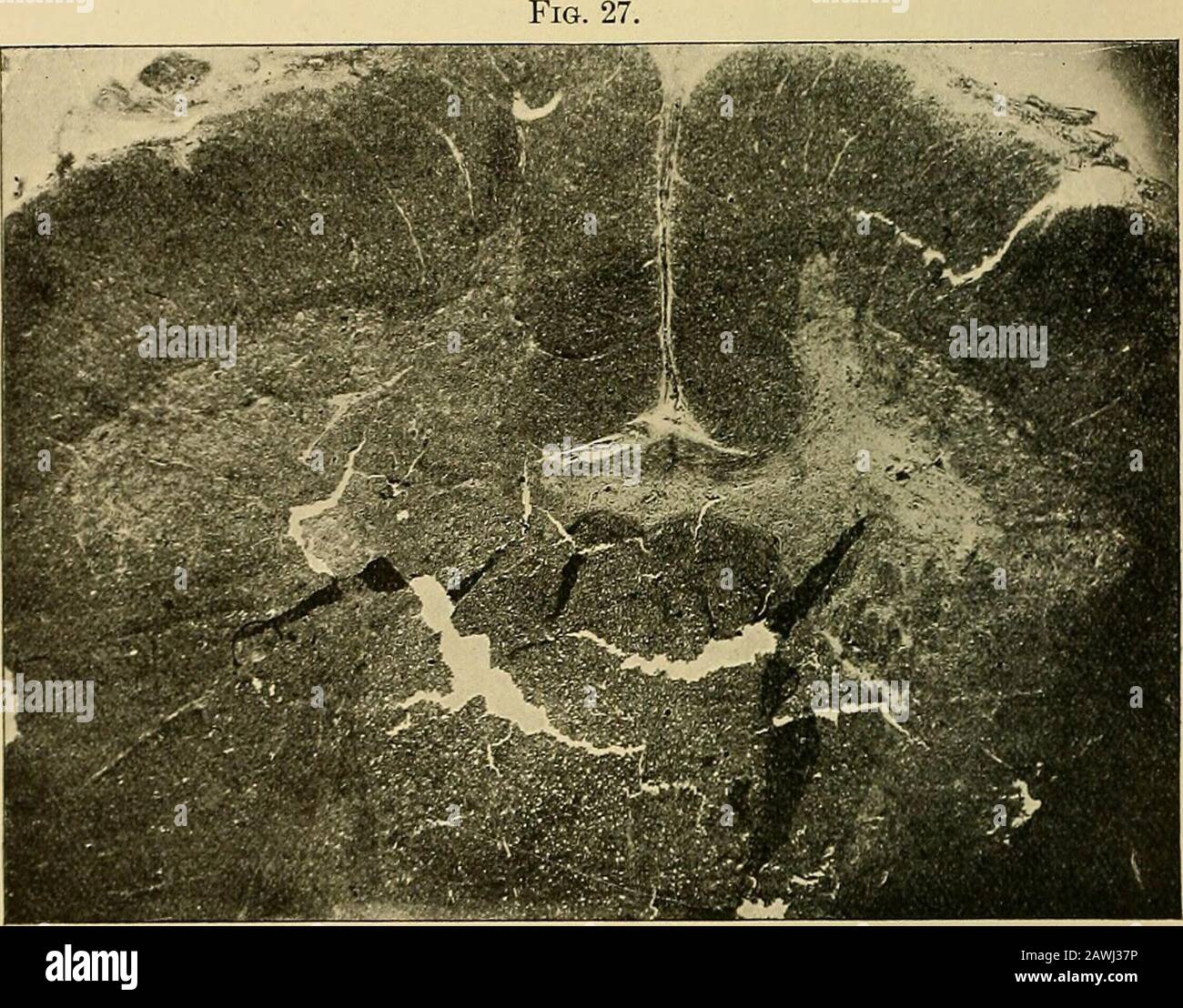 Neuraxon hi-res stock photography and images - Alamy