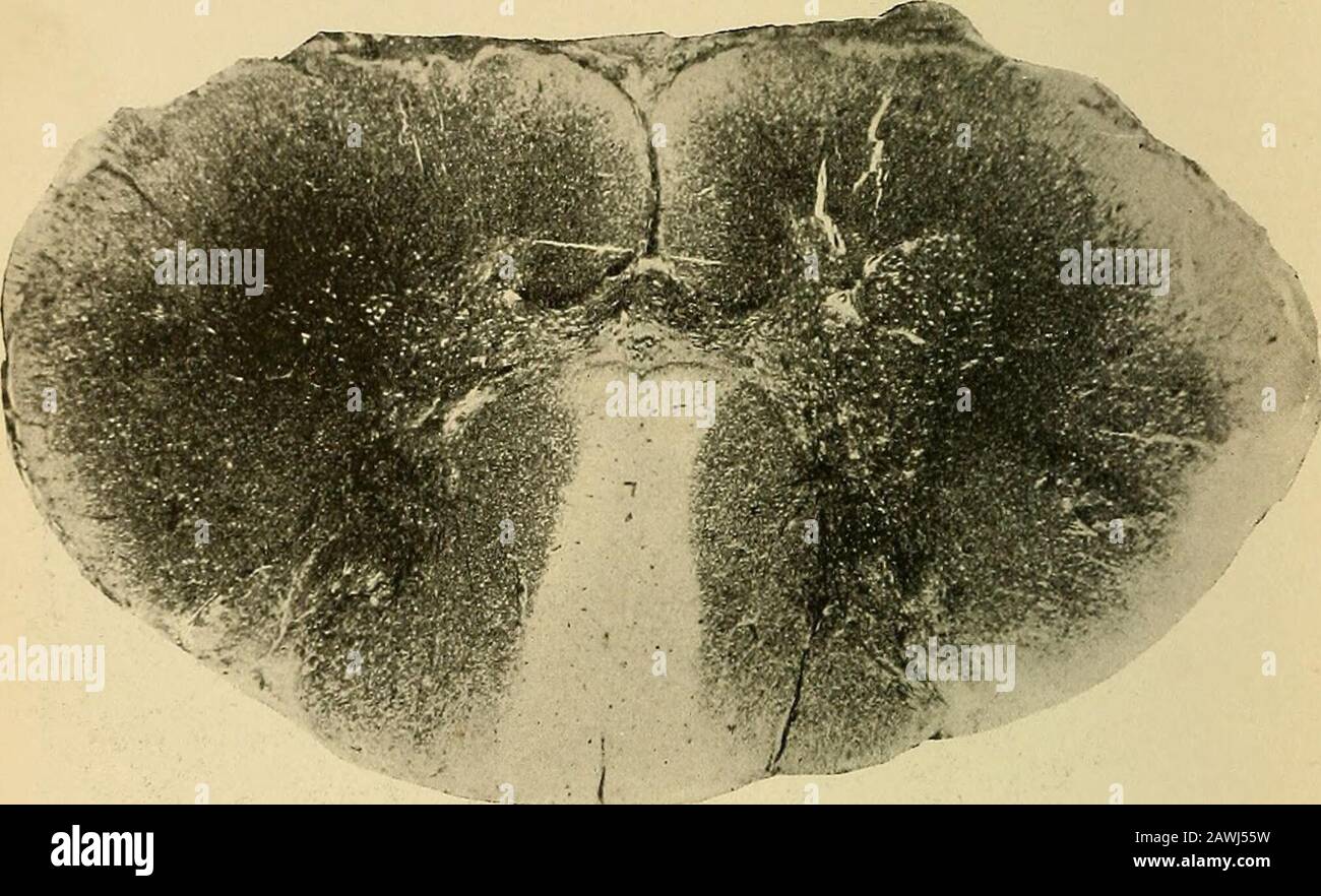 Spinal columns hi-res stock photography and images - Alamy