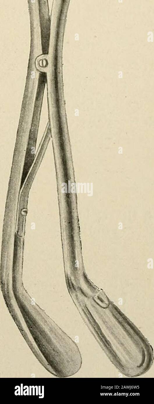 The practice of surgery . Fig. 14-1.—The dilating ends of Fig. 145 ...