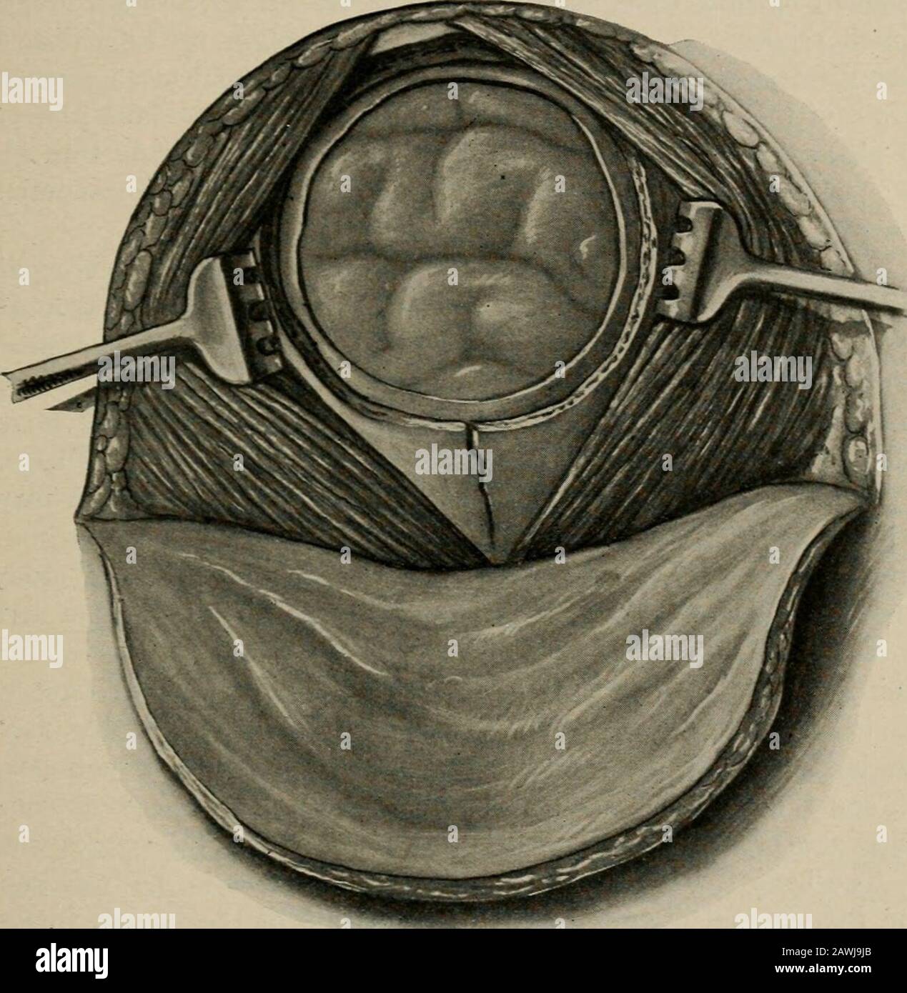 Operative surgery, for students and practitioners . he head. The ...