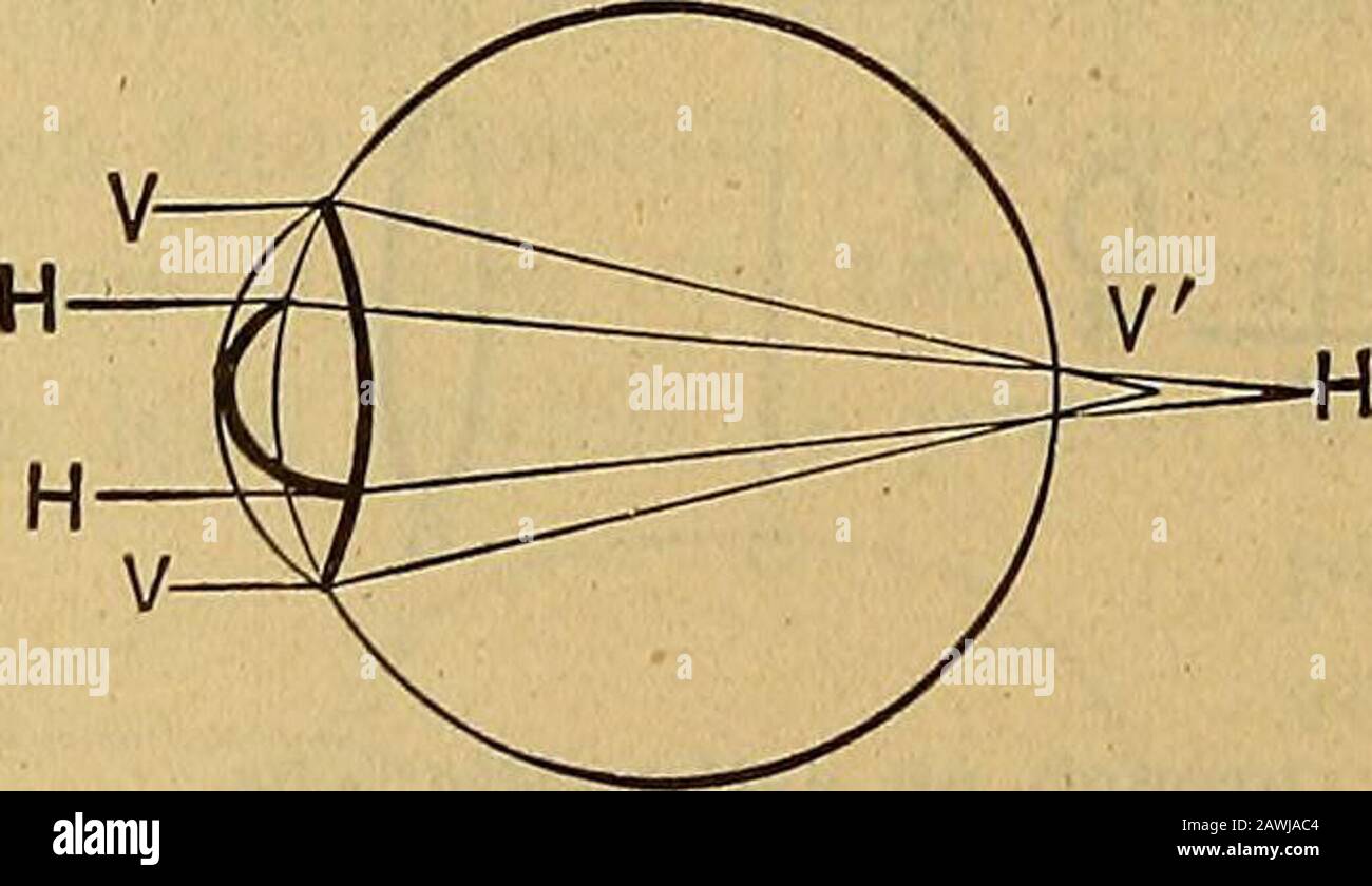 Manual of ophthalmology . Fig. 30. Fig. 31. which will converge the ...