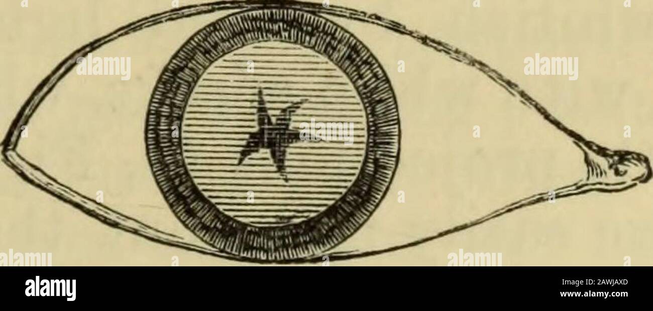 Nuclear cataract hi-res stock photography and images - Alamy