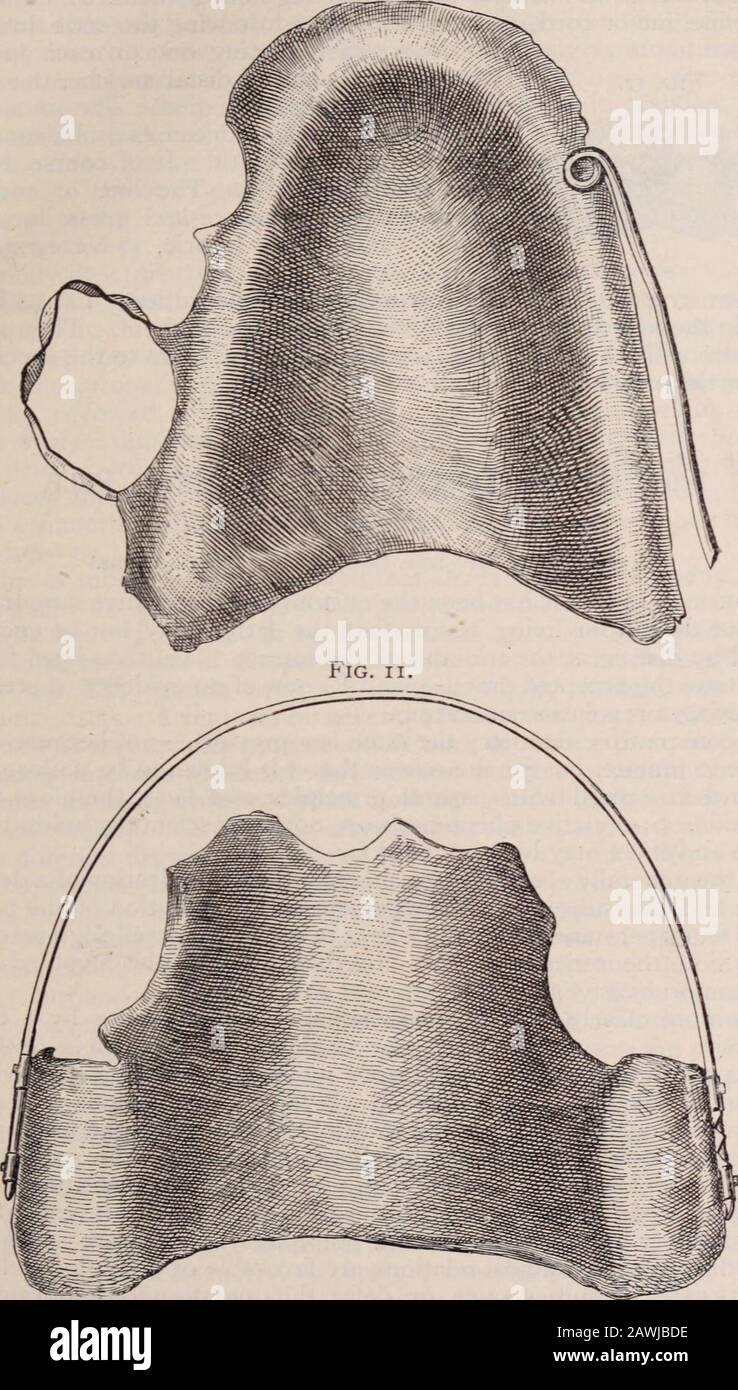 Dental cosmos . lengthened or shortened by these nuts. It is much ...