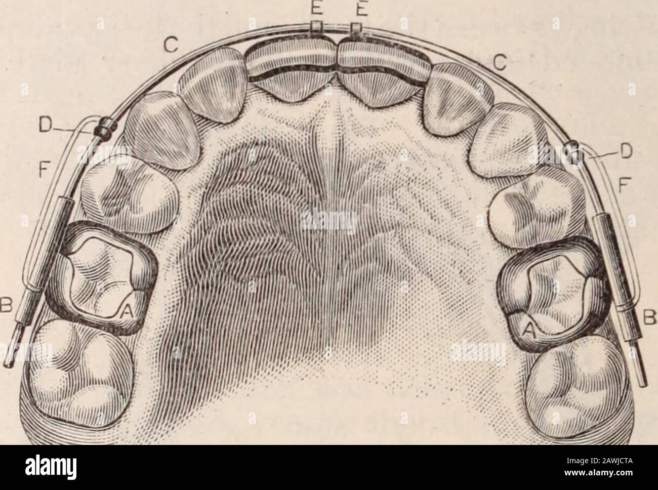 Labial superior hi-res stock photography and images - Alamy
