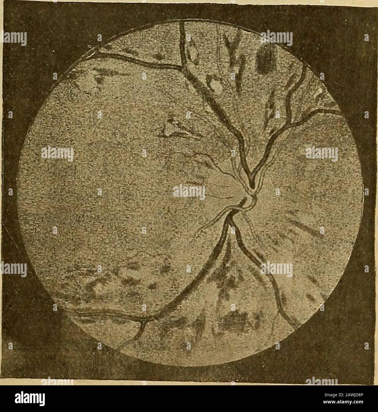 Retinal layers hi-res stock photography and images - Alamy