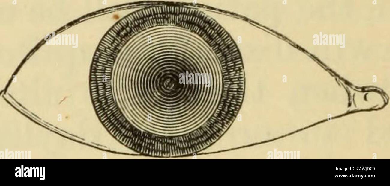 The student's guide to diseases of the eye . Fig. 59.—Nuclear cataract ...