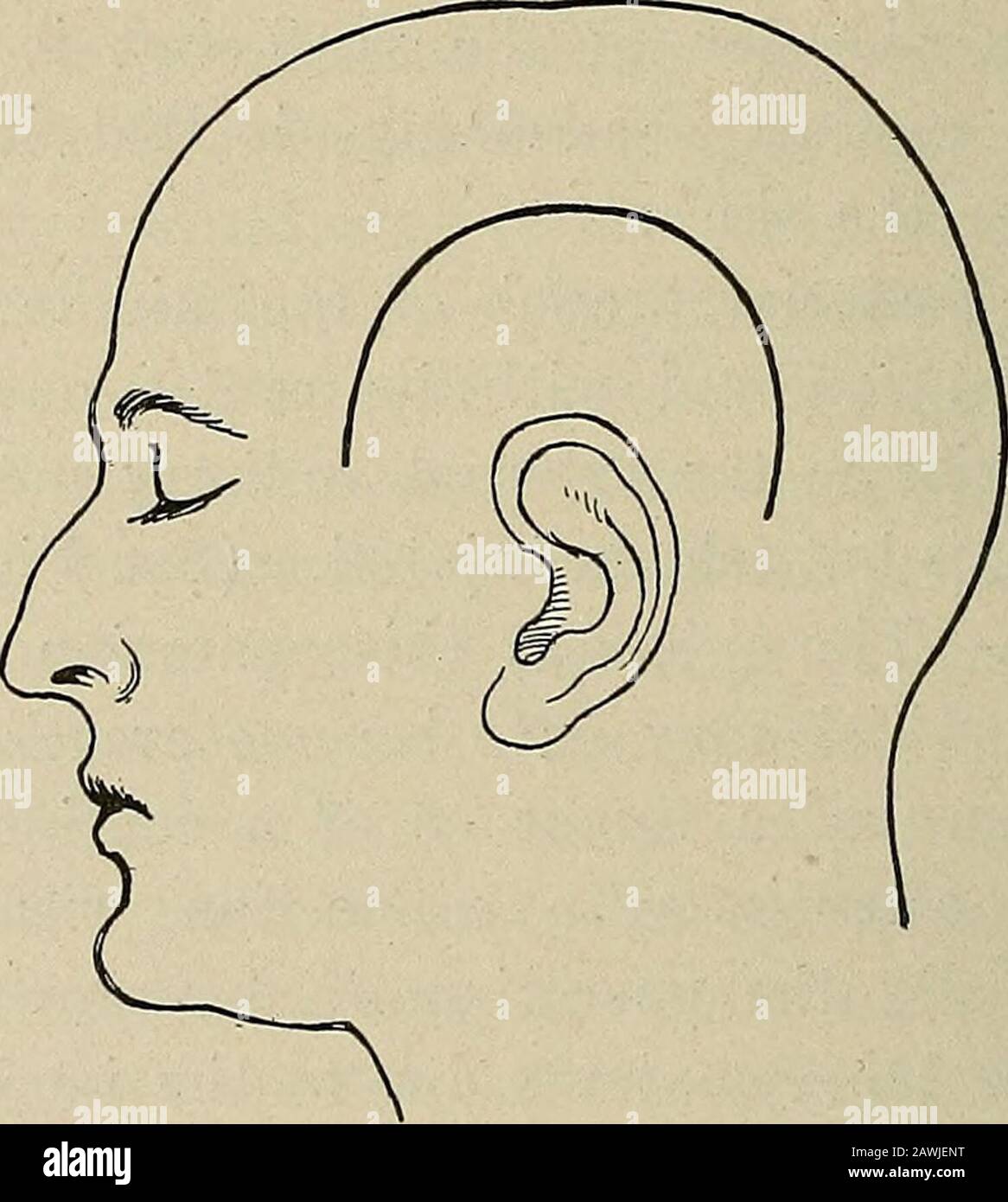 Operative surgery, for students and practitioners . ^ the edges of the ...