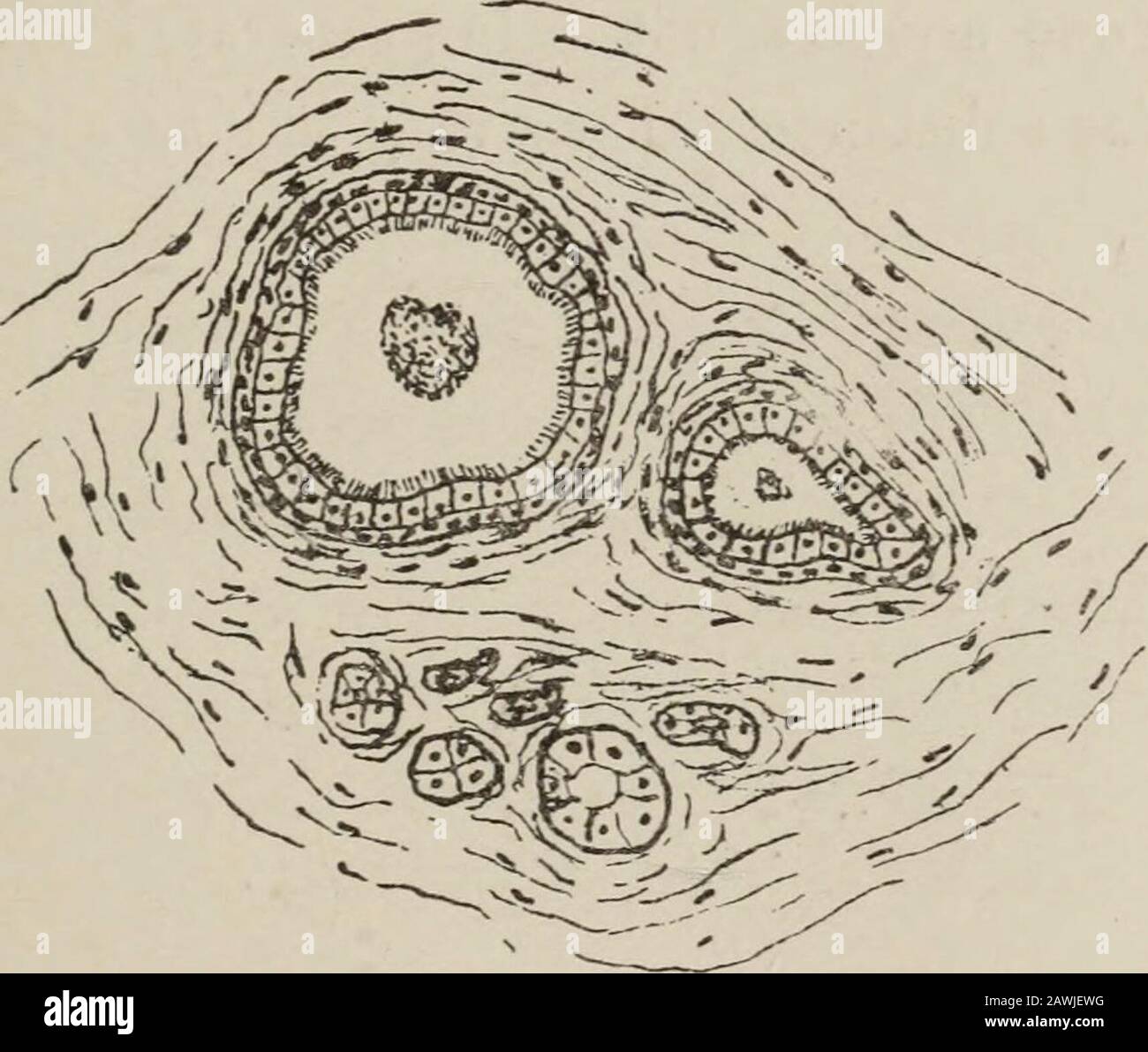 General surgery and pathology for dentists . Fig. 17.PAPILLOMA OF SKIN ...