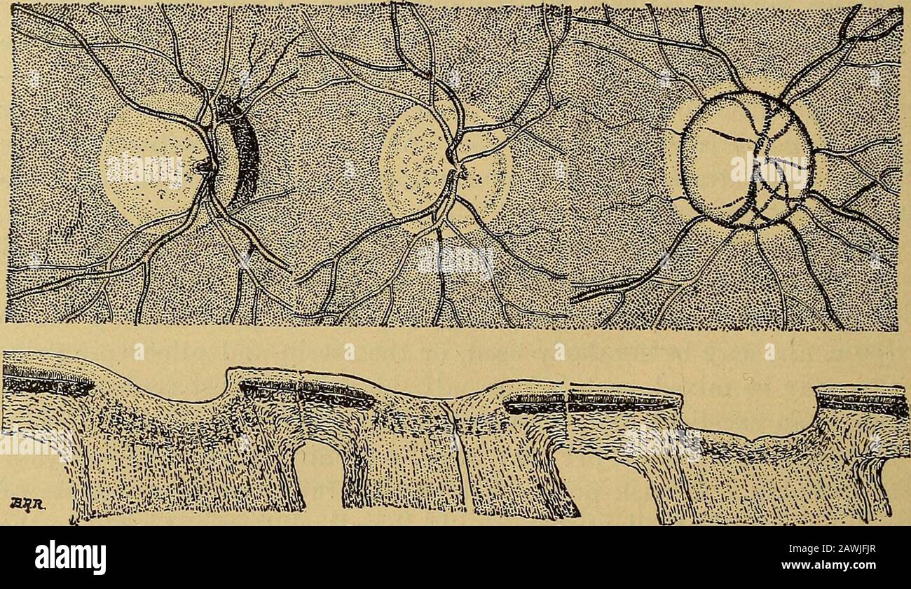 Eyeground hi-res stock photography and images - Alamy