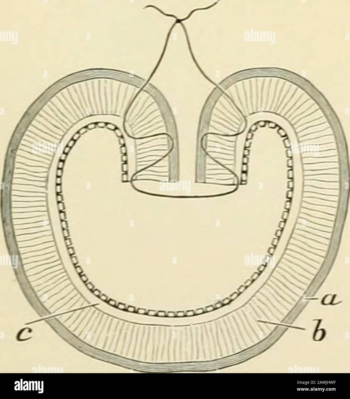 Operative surgery . Fig. 789. The Wolfler su-ture, sectional view. Fig ...