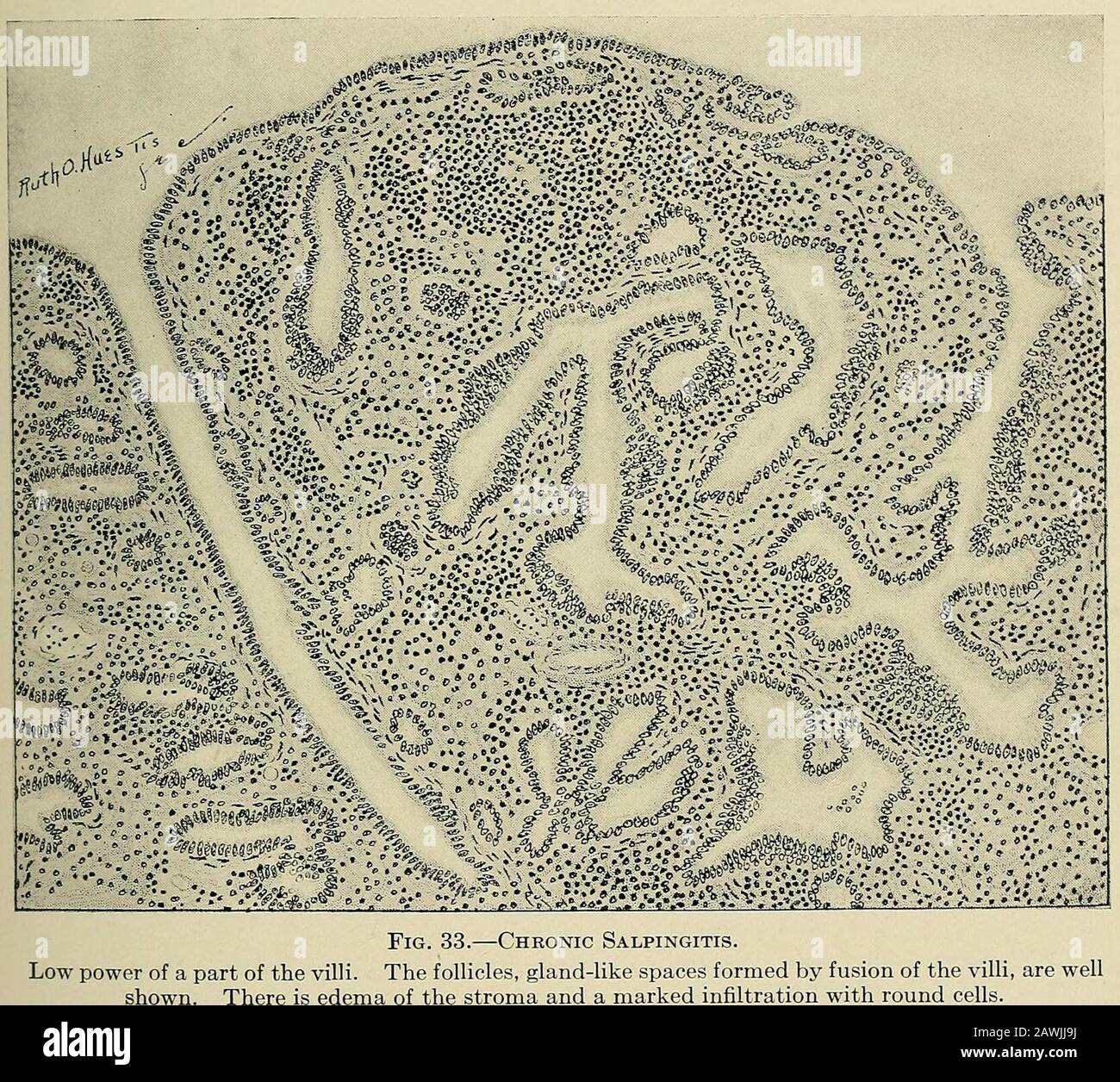Luteal cells hi-res stock photography and images - Alamy