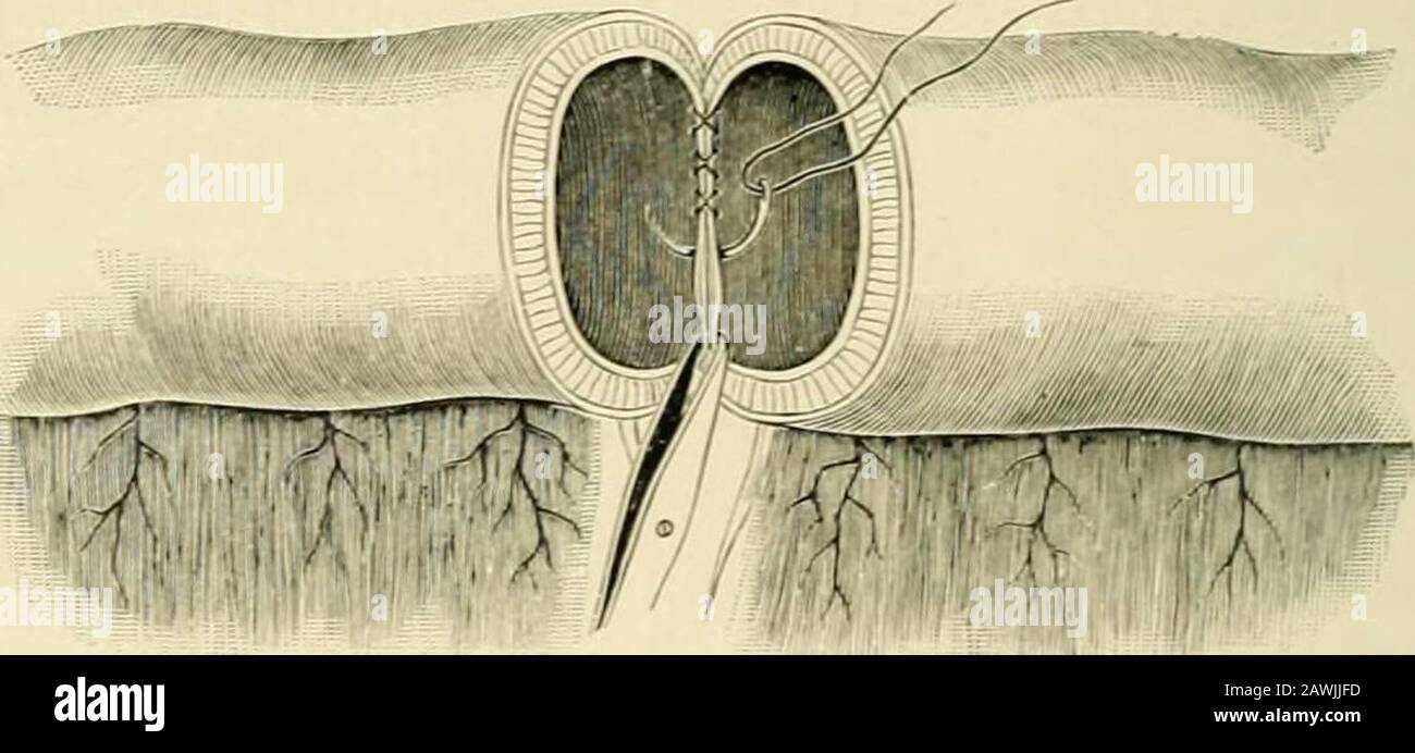 Sectional View Fig High Resolution Stock Photography and Images - Alamy