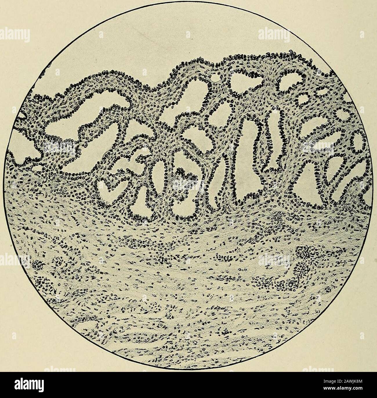 Peritoneum the bladder hi-res stock photography and images - Alamy