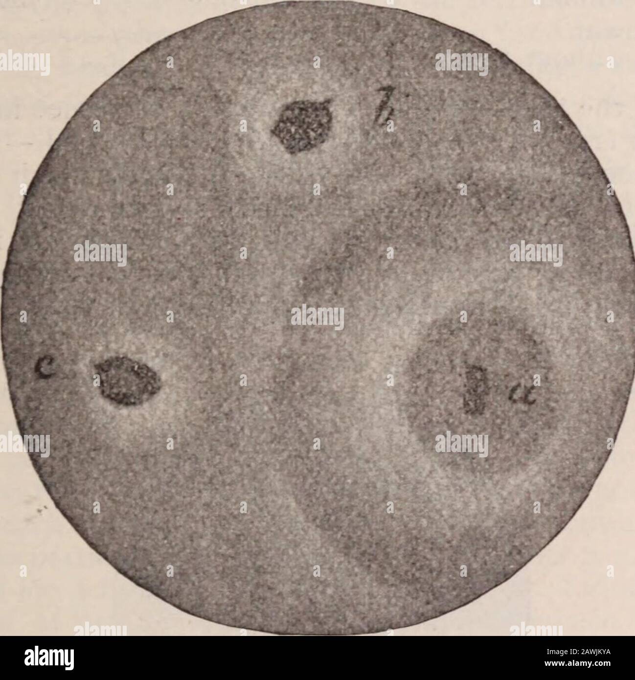 Dental cosmos . a, a portion of a putrid pulp mixed with subli-mate; b ...