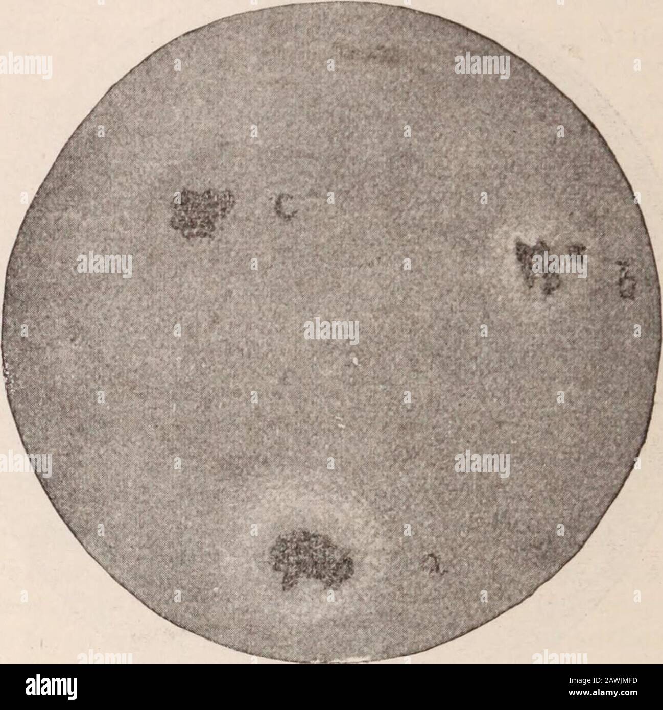 Dental pulps hi-res stock photography and images - Alamy