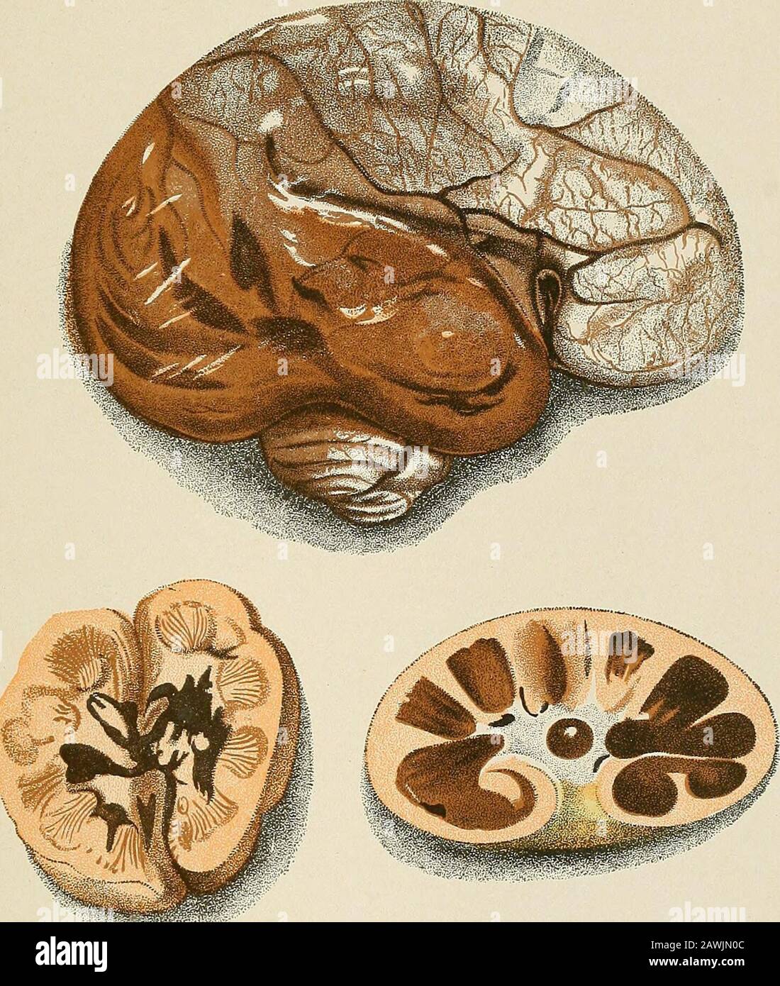 Subpleural hi-res stock photography and images - Alamy