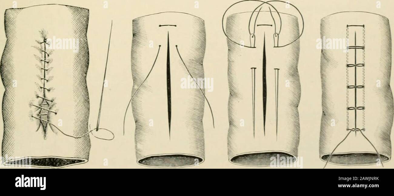 Operative surgery . practicability established byexperienced use ...