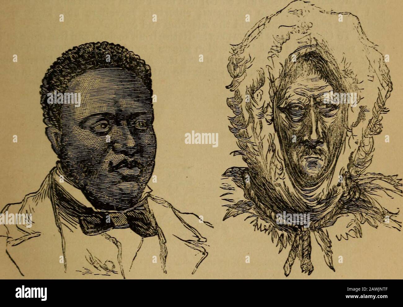 Forgive All Injuries