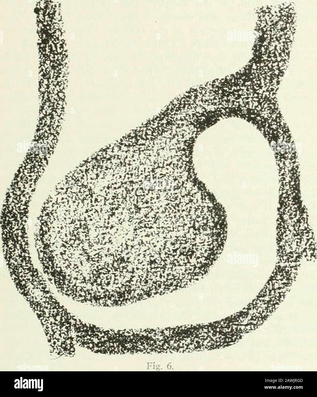 Inferior Turbinate High Resolution Stock Photography and Images - Alamy