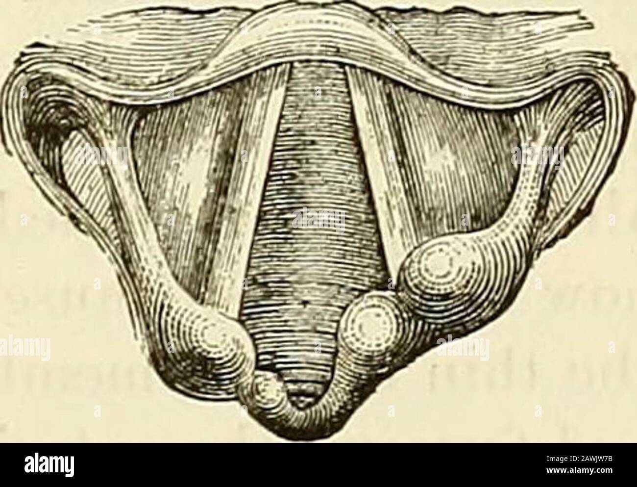 Cadaveric hi-res stock photography and images - Alamy