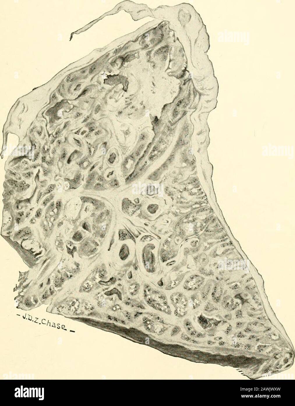 Connectivetissue hi-res stock photography and images - Alamy