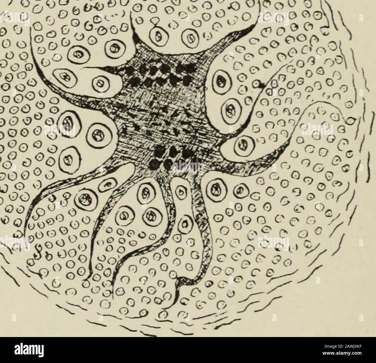 Scrofulous hi-res stock photography and images - Alamy