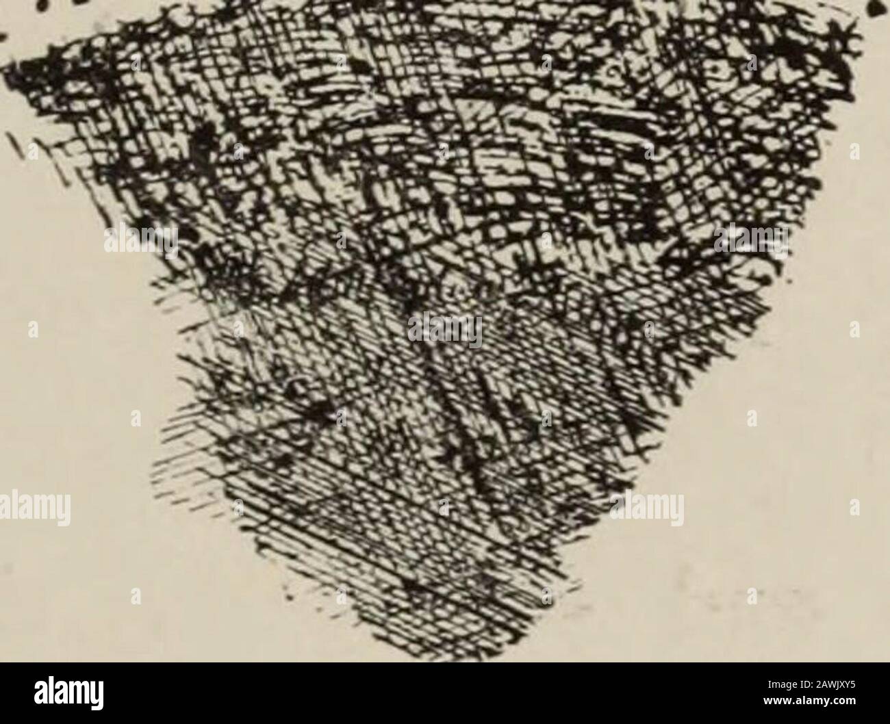 Syphilis ulcers hi-res stock photography and images - Alamy